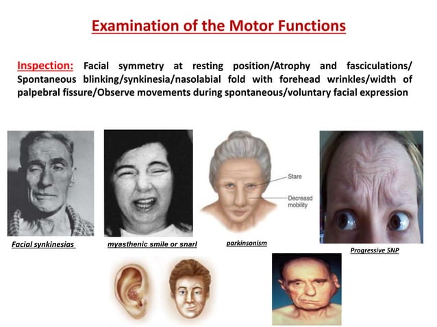 facial nerve examination | PPTX | Ear, Nose and Throat Conditions ...