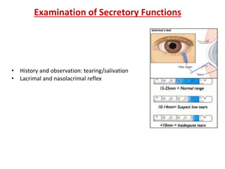 facial nerve examination | PPTX