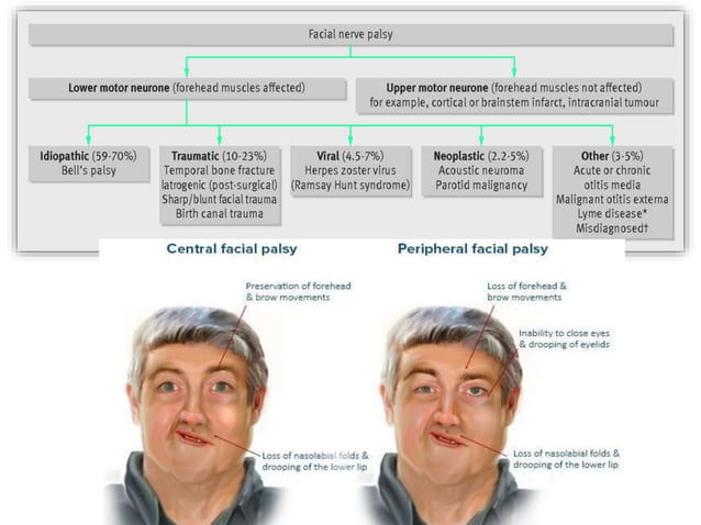 facial nerve examination | PPTX | Ear, Nose and Throat Conditions ...