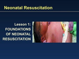 7th Ed NRP - English - Lesson 1 resuscitation | PPTX
