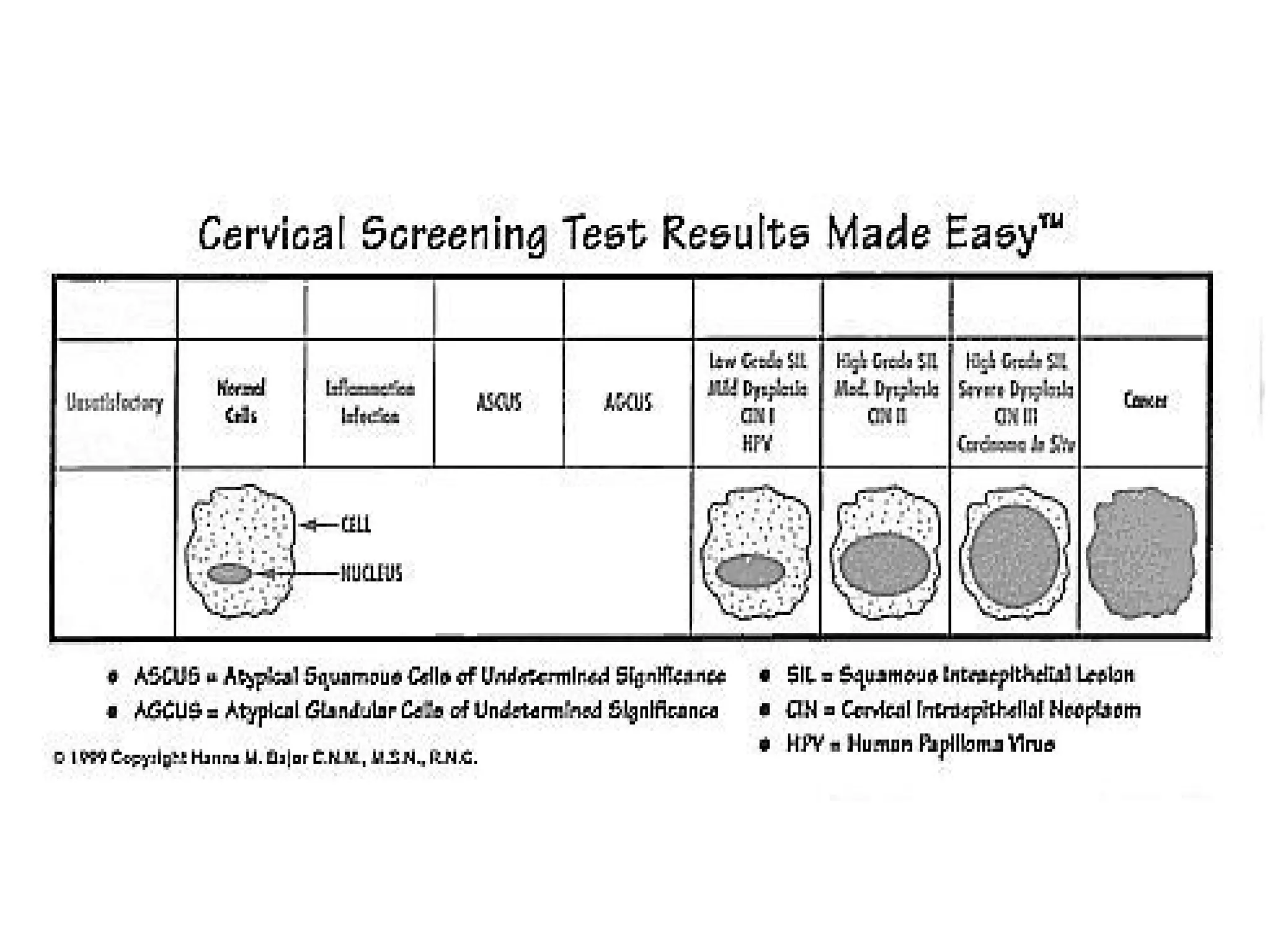 Evidence Based Guide of Screening for Prevention of Cervical Cancer | PPT