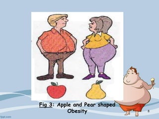 Types of obesity & its Dietary Pills | PPT