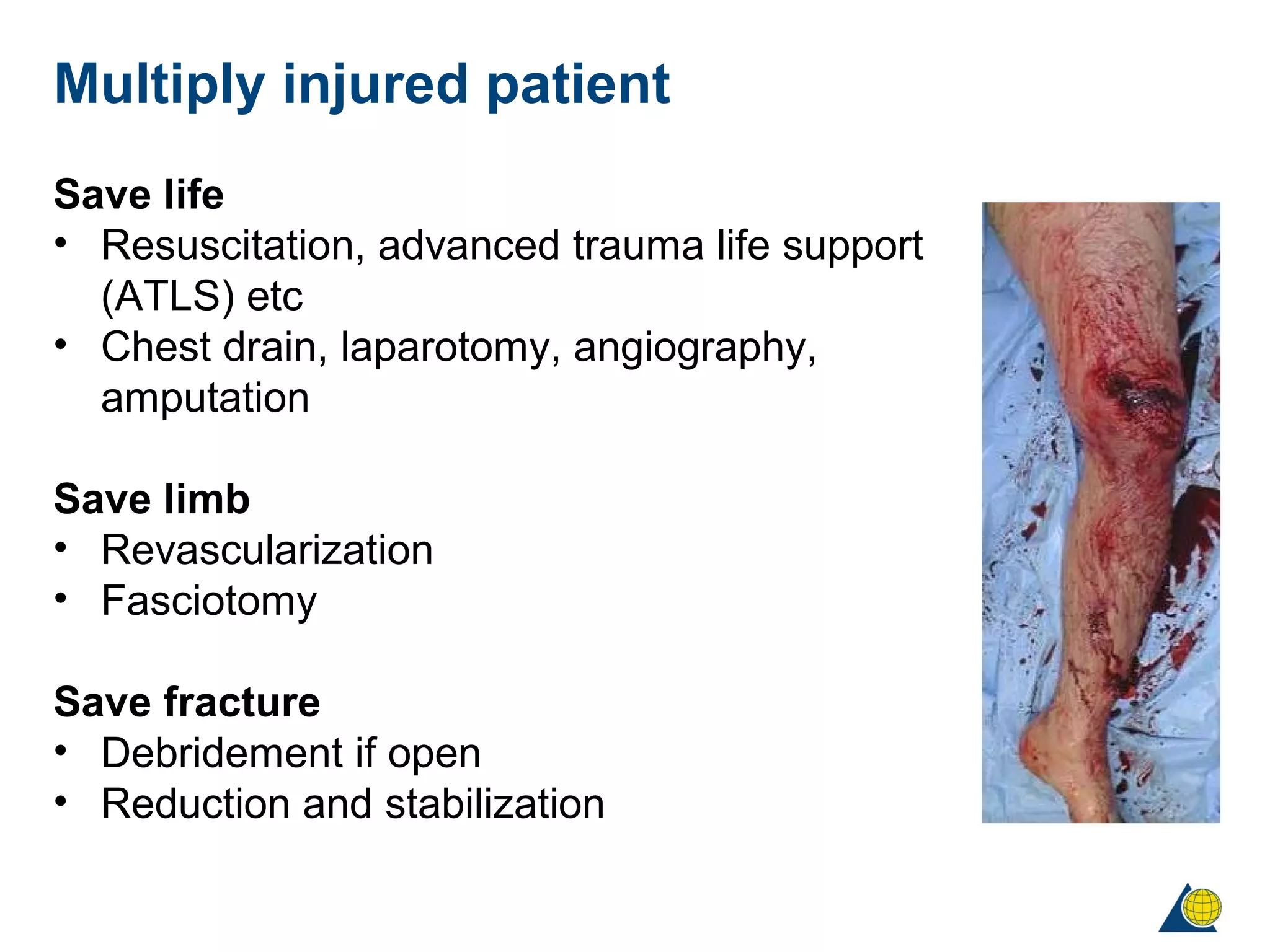Principles of fracture management | PPT