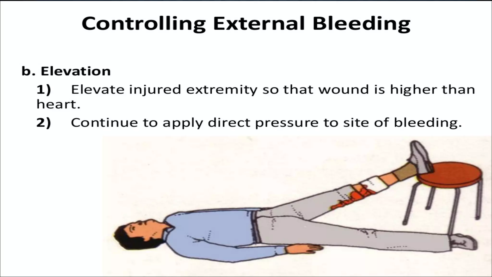 Controlling external bleeding | PDF