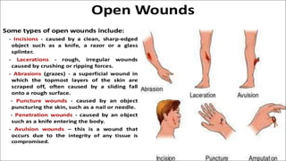 Controlling external bleeding | PDF