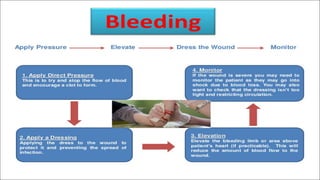 Controlling external bleeding | PDF