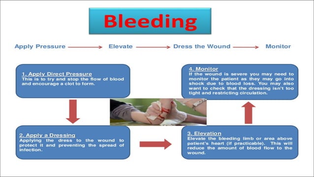 Controlling external bleeding | PDF