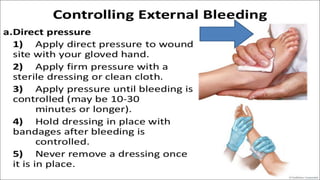 Controlling external bleeding | PDF