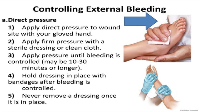 Controlling external bleeding | PDF