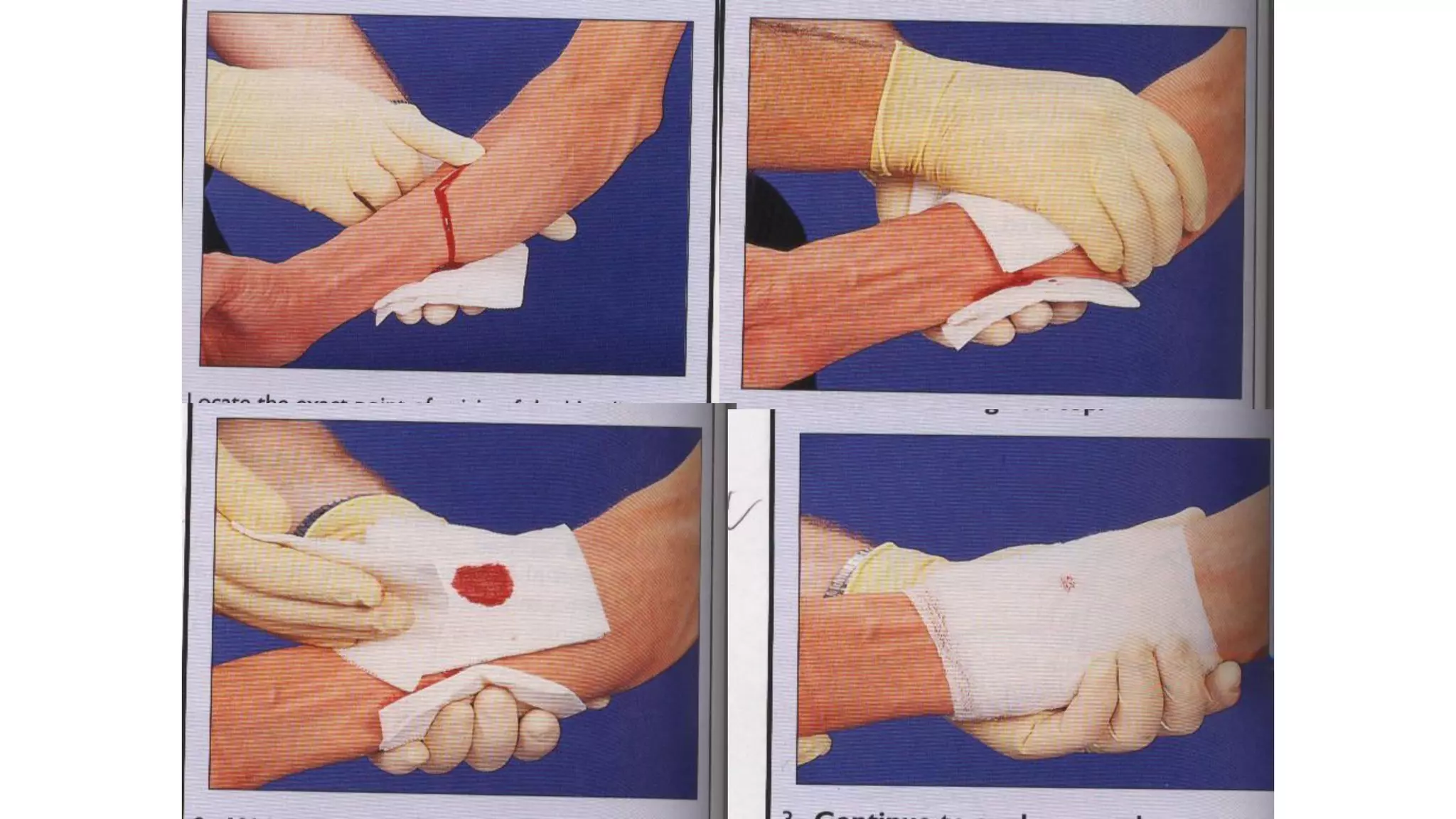 7 Trauma Muskuloskeletal | PDF