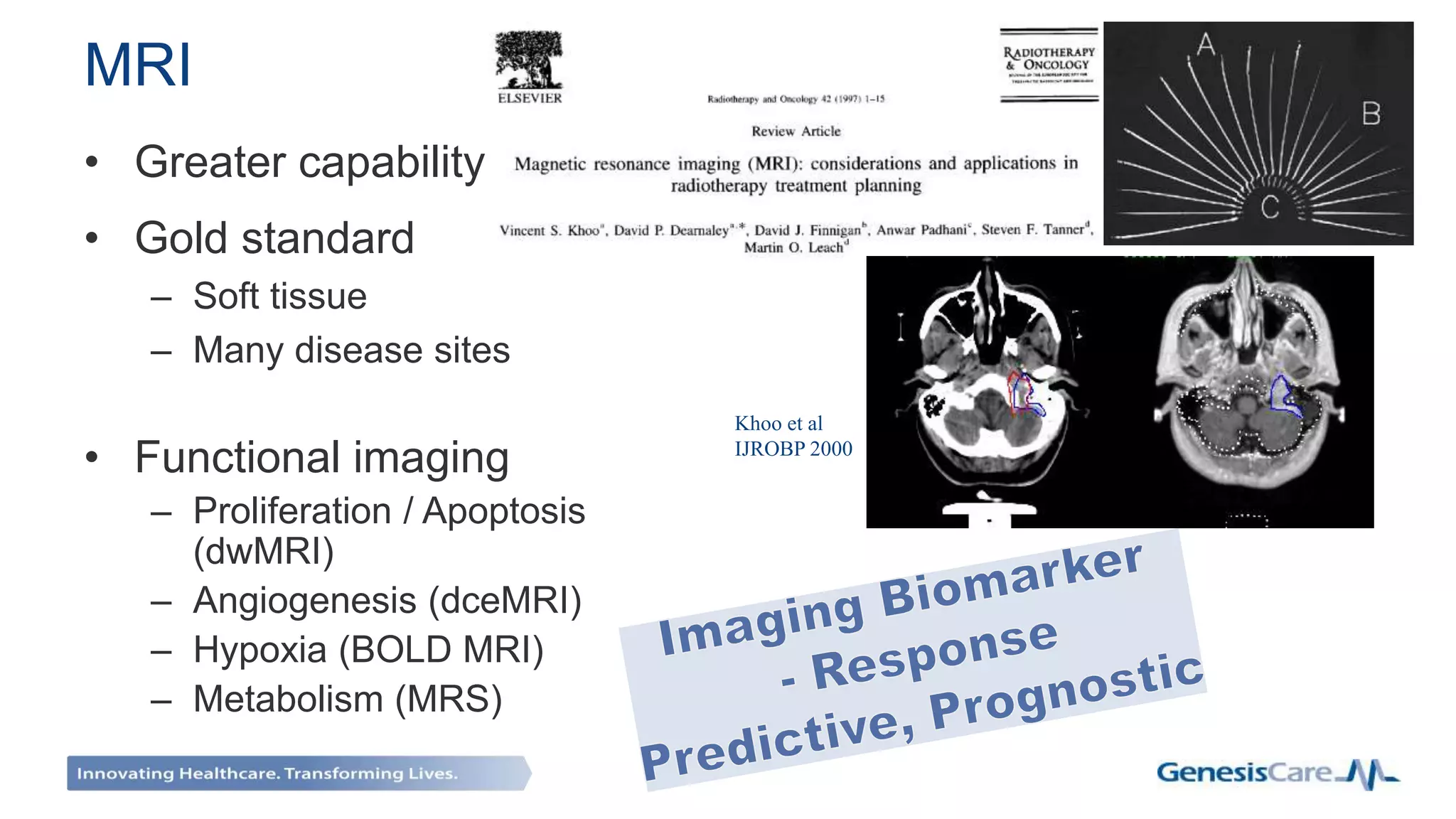 Dr Vincent Khoo, CMO, GenesisCare - MRLinac | PPTX