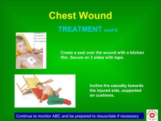 7 wounds and bleeding | PPT