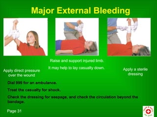 7 wounds and bleeding | PPT