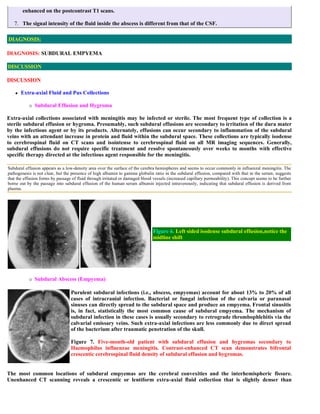 Case record...Subdural empyema | PDF