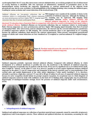 Case record...Subdural empyema | PDF