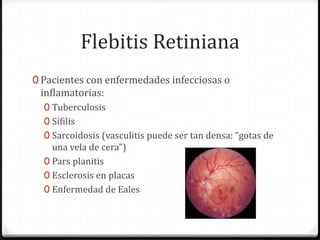 8. enfermedades venosas de la retina | PPTX