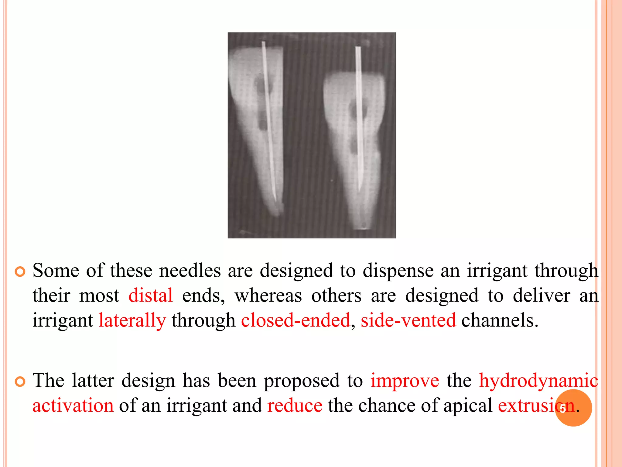 Recent advances in endodontic irrigation devices | PPTX