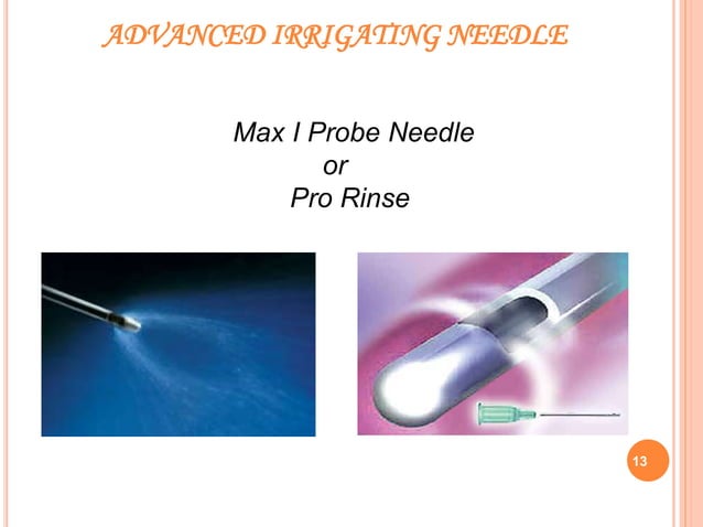 Recent advances in endodontic irrigation devices | PPTX