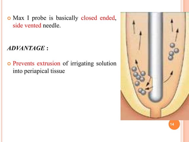 Recent advances in endodontic irrigation devices | PPTX