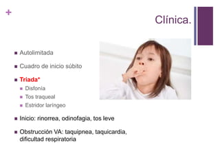 Laringotraqueitis (croup) y epiglotitis por Nadia Menéndez Auld | PPTX