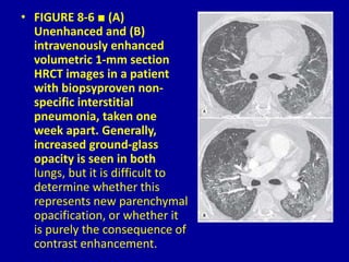 8 Techniques in Thoracic Imaging Dr. Muhammad Bin Zulfiqar Grainger and ...