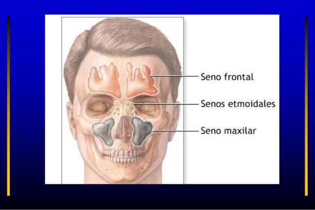 senos maxilares