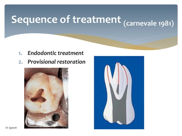 furcation involvement | PPTX