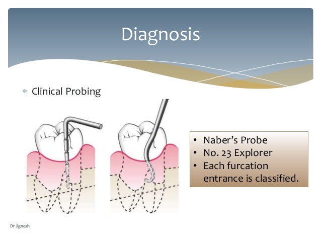 furcation involvement