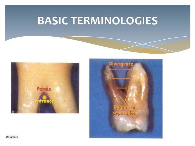 furcation involvement