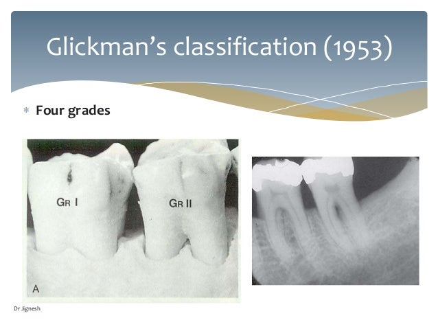 furcation involvement