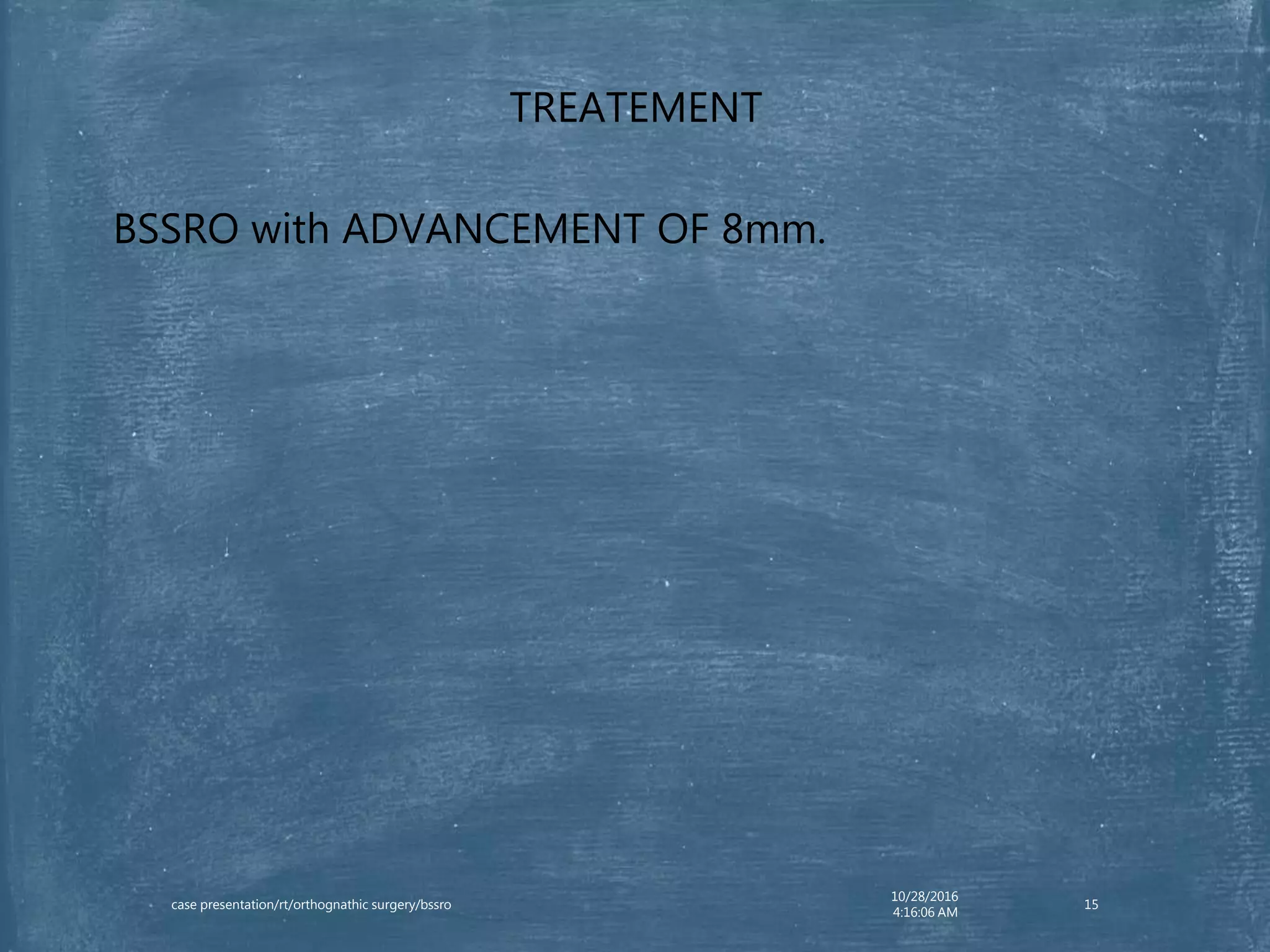 Dr. RAHUL VC TIWARI, SIBAR INSTITUTE OF DENTAL SCIENCES, GUNTUR, ANDHRA PRADESH, INDIA. TMJ ...