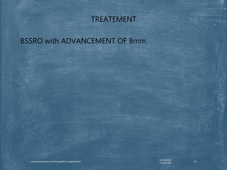 Dr. RAHUL VC TIWARI, SIBAR INSTITUTE OF DENTAL SCIENCES, GUNTUR, ANDHRA ...