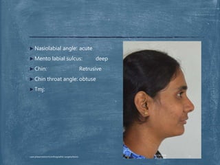 Dr. RAHUL VC TIWARI, SIBAR INSTITUTE OF DENTAL SCIENCES, GUNTUR, ANDHRA ...