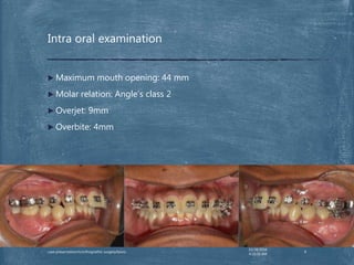 Dr. RAHUL VC TIWARI, SIBAR INSTITUTE OF DENTAL SCIENCES, GUNTUR, ANDHRA ...
