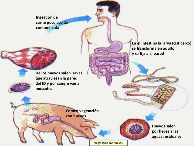 Enfermedades parasitarias