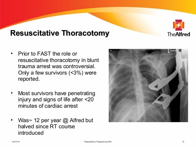 Resuscitative Thoracotomy - Mark Fitzgerald