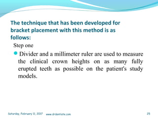 mbt bracket placement | PPT