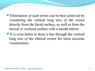 mbt bracket placement | PPT