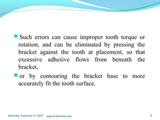 mbt bracket placement | PPT