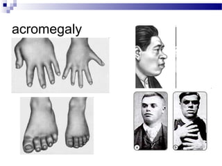 Endocrine system in children. Semiotics diseases | PPT