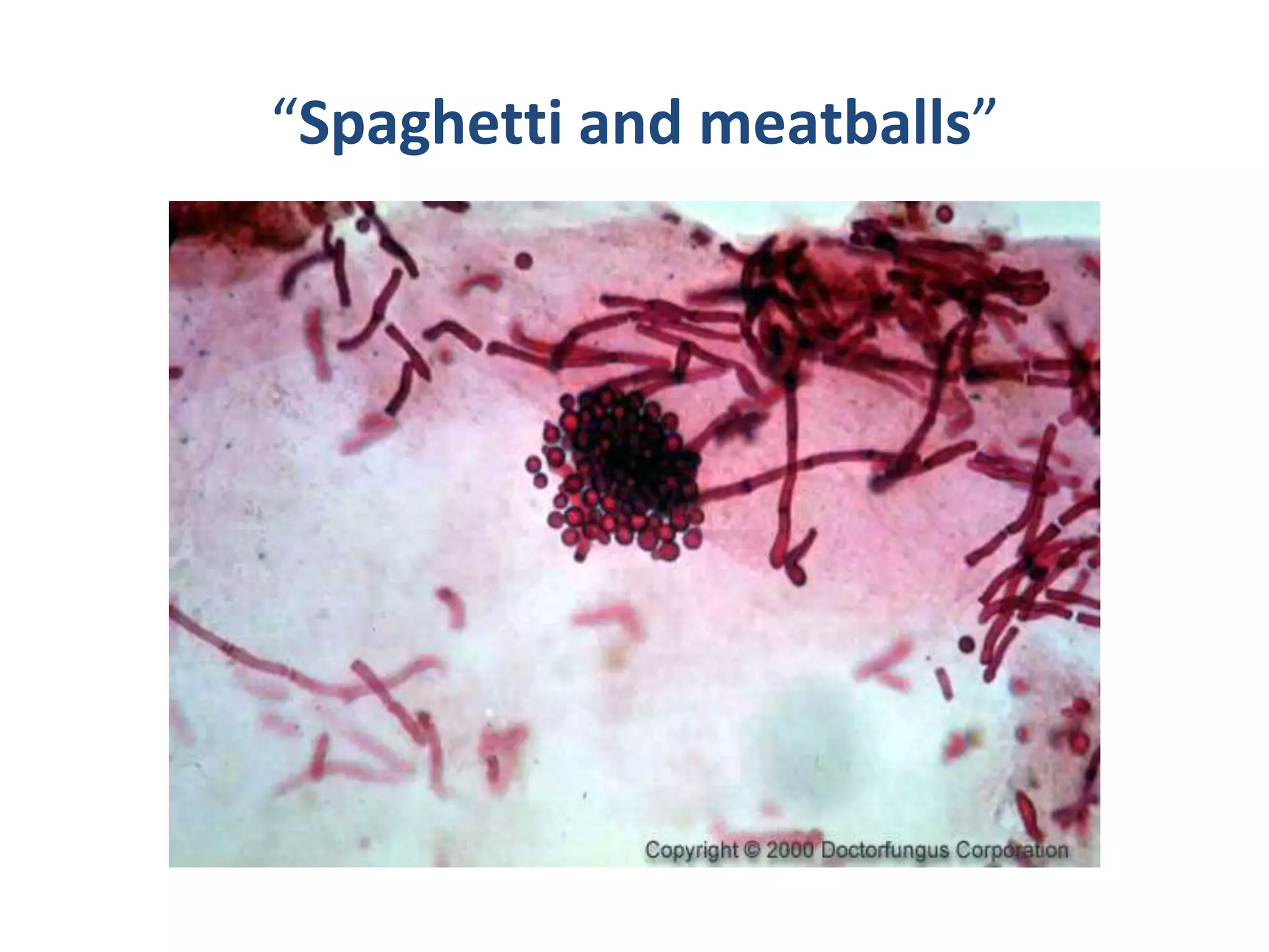 Superficial Mycoses | PPTX | Skin and Dermatology | Diseases and Conditions