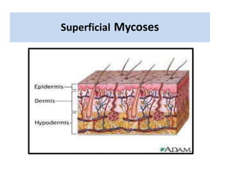 Superficial Mycoses | PPTX