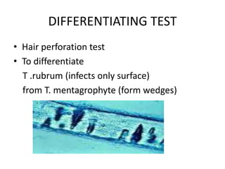 Superficial Mycoses | PPTX