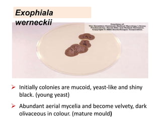 Superficial Mycoses | PPT