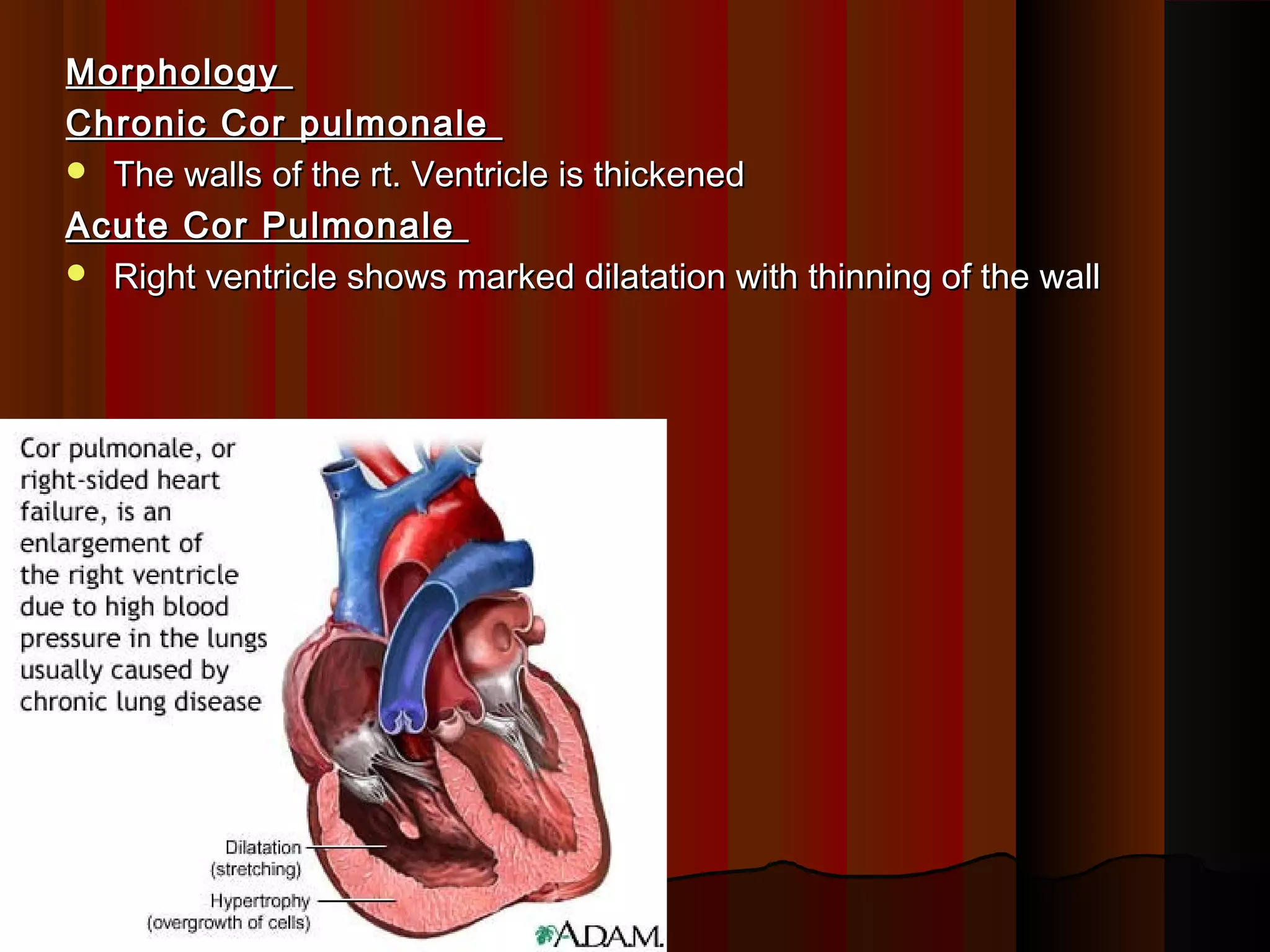8.cor pulmonale | PPT