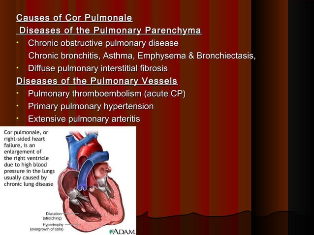 8.cor pulmonale | PPT
