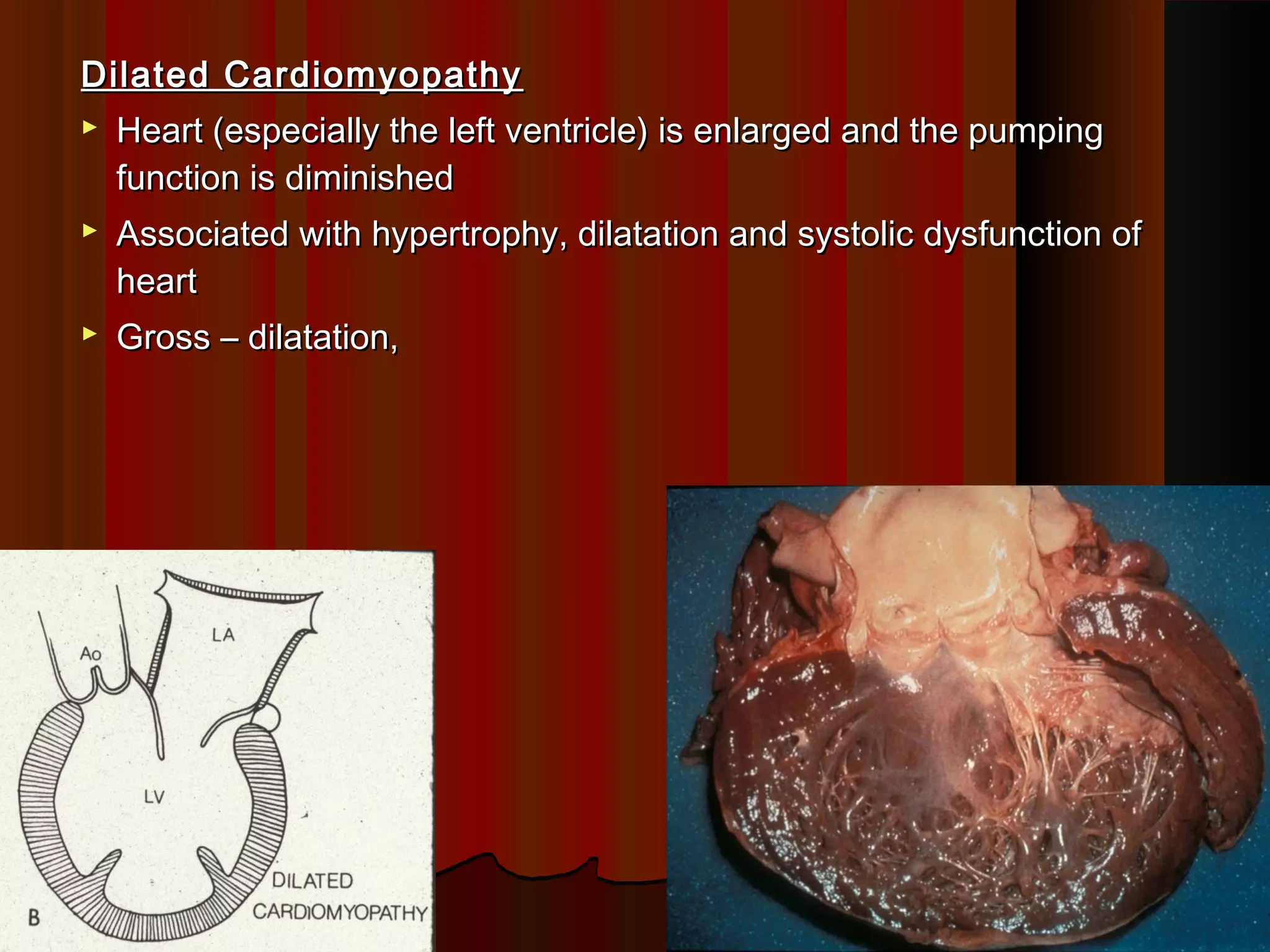 8. Disease of myocardium | PPT