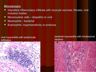 8. Disease of myocardium | PPT
