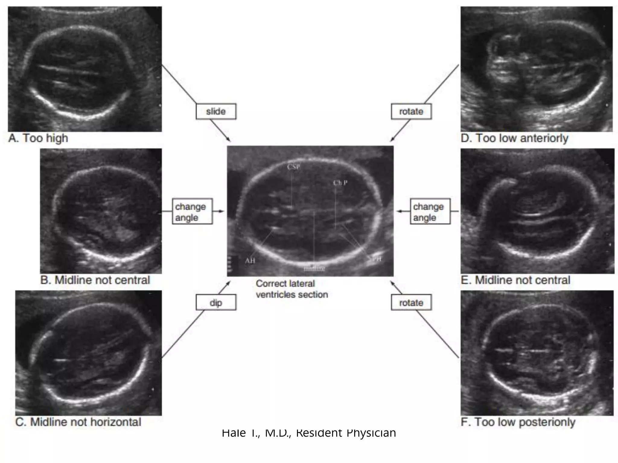 8. normal second trimester ultrasound | PDF