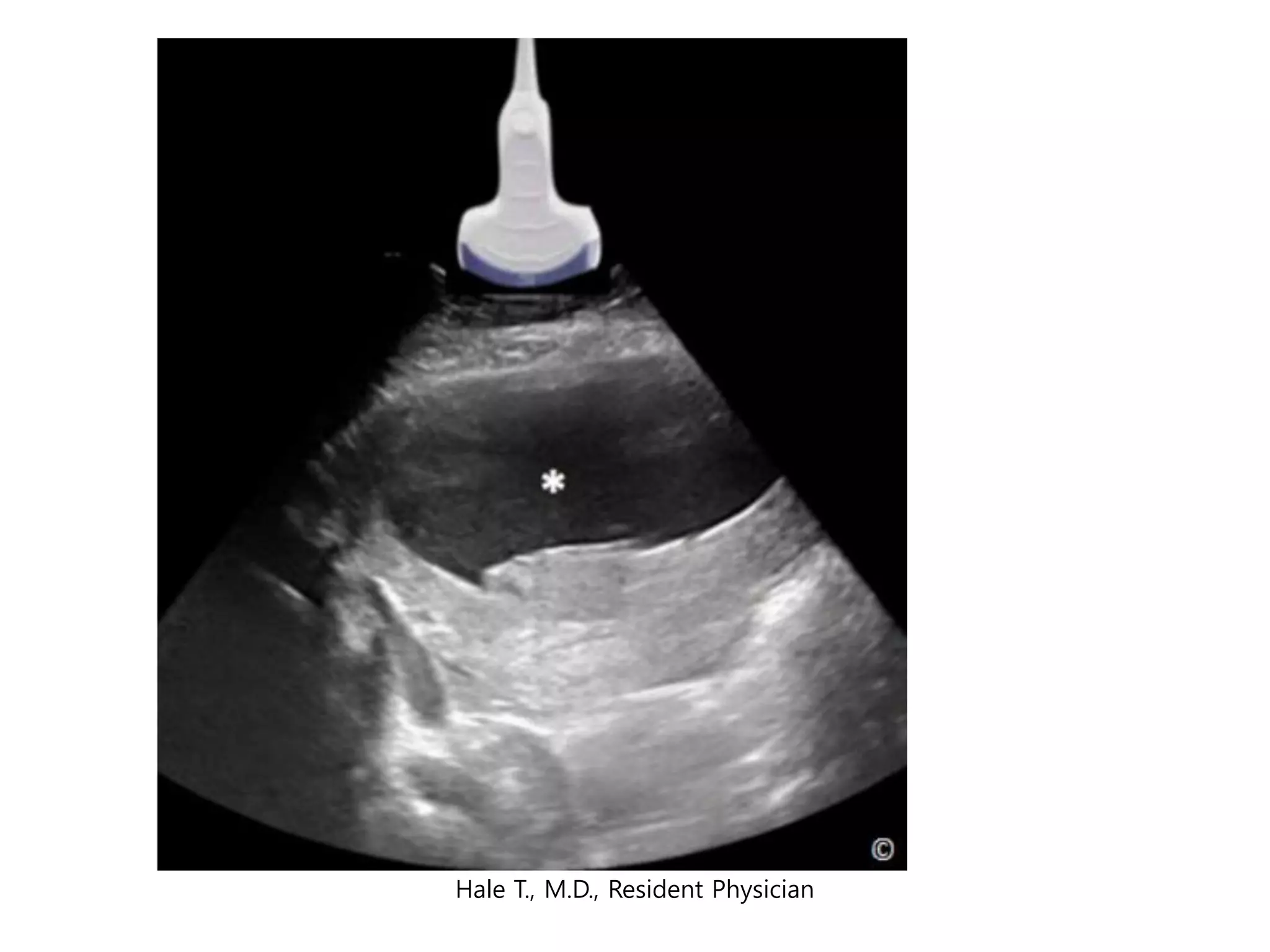 8. normal second trimester ultrasound | PDF